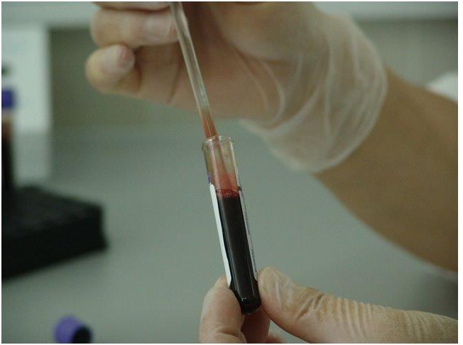 Gasometro aparelho - GASOMEX