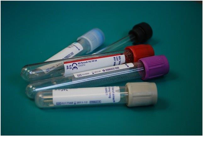 Gasometro instrumento de laboratorio - GASOMEX